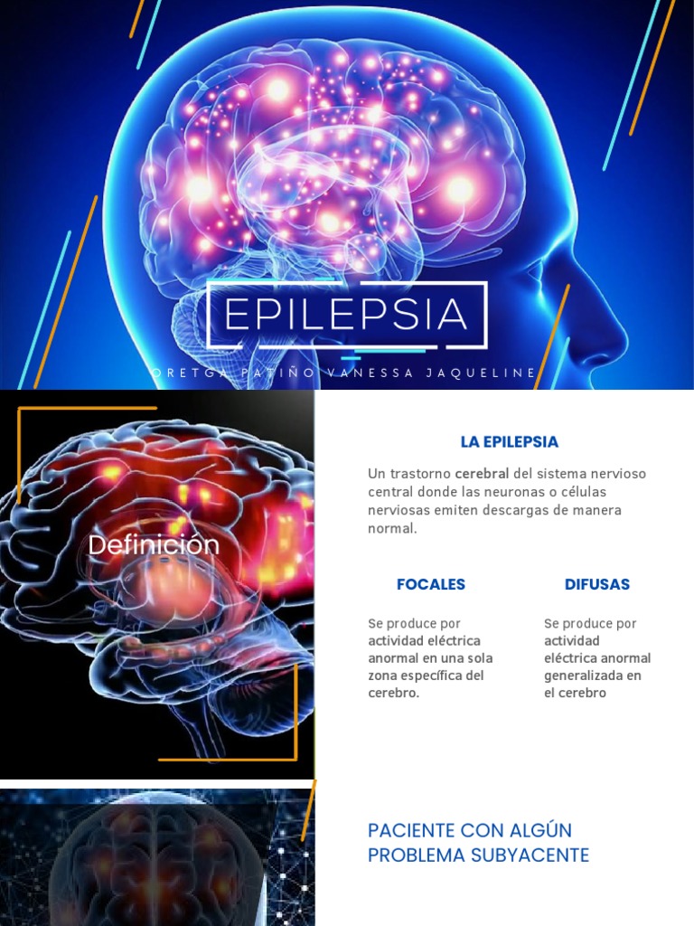 EPILEPSIA | PDF | Epilepsia | Cerebro