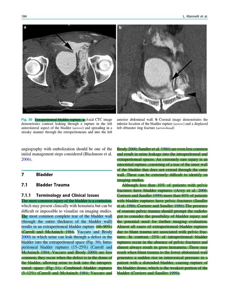Bladder Trauma: Imaging and Management | PDF | Peritoneum | Ct Scan