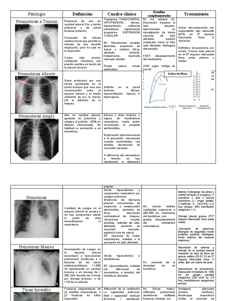 Manejo de Neumotórax y Tórax Inestable | PDF | Tórax (anatomía humana ...
