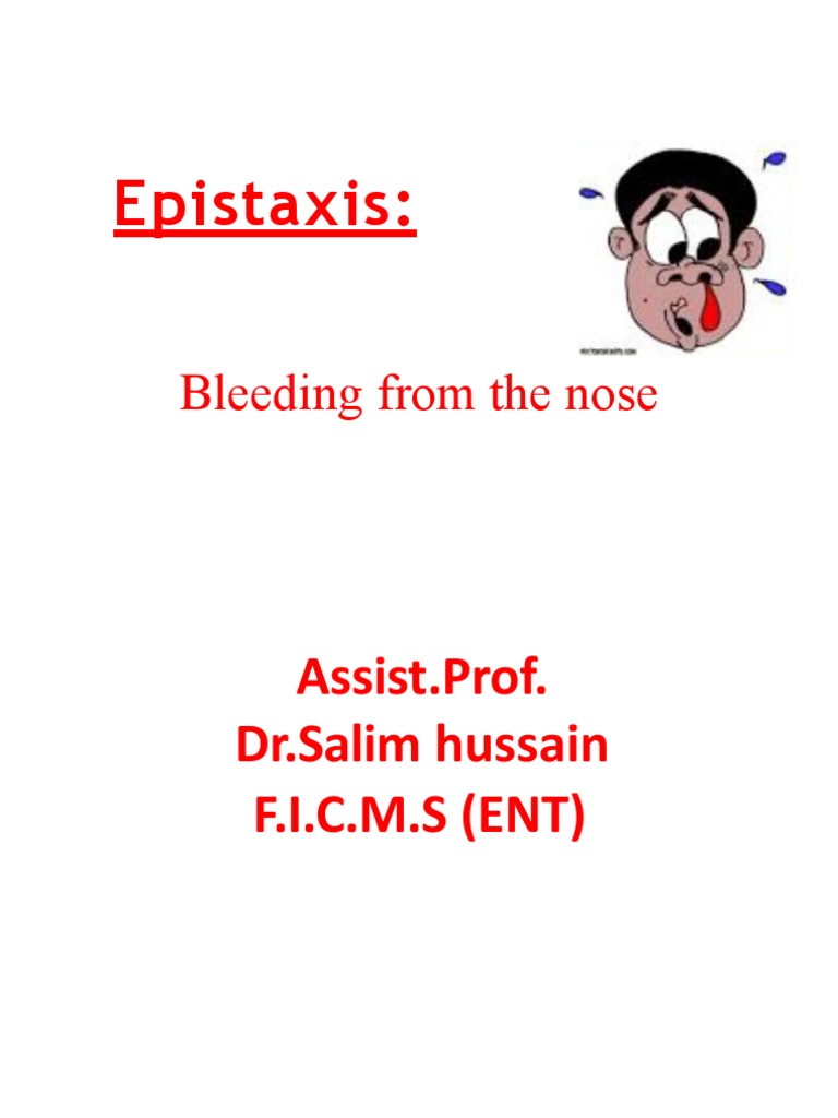 Epistaxis 2019 | PDF | Human Nose | Bleeding