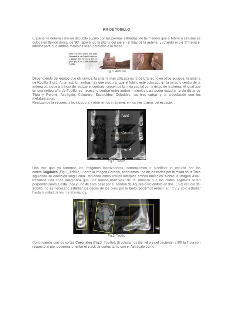 RM de Tobillo: Fig.8 - Antenas | PDF | Tobillo | Mano