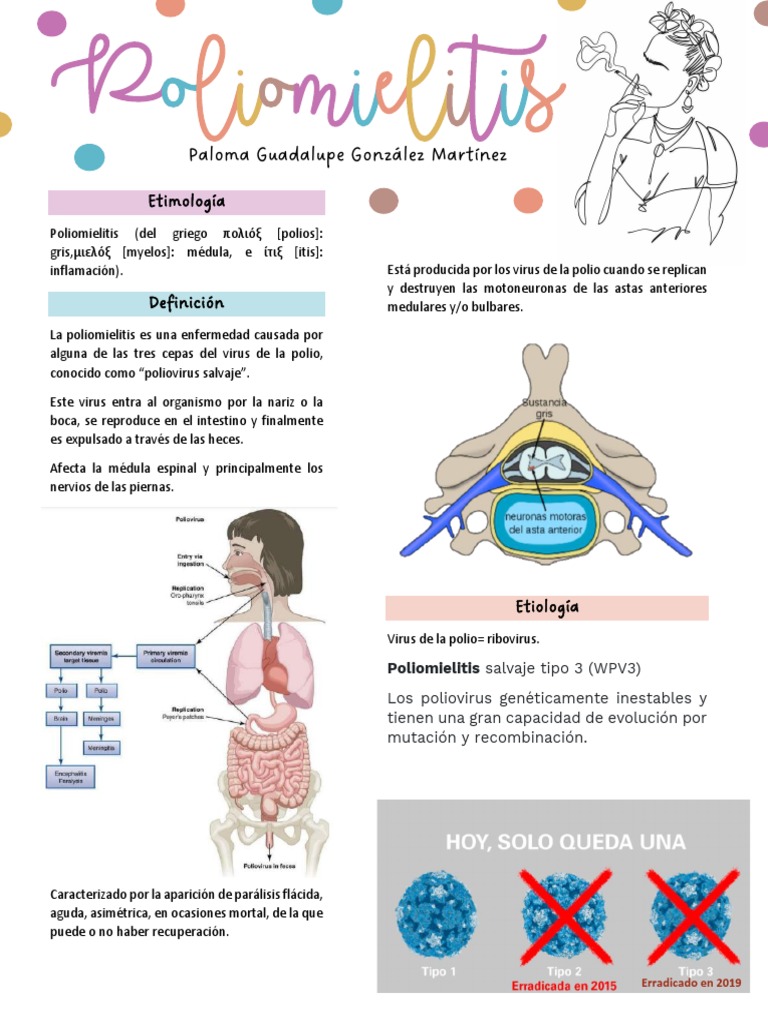 Poliomielitis | PDF | Enfermedades y trastornos | Medicina CLINICA