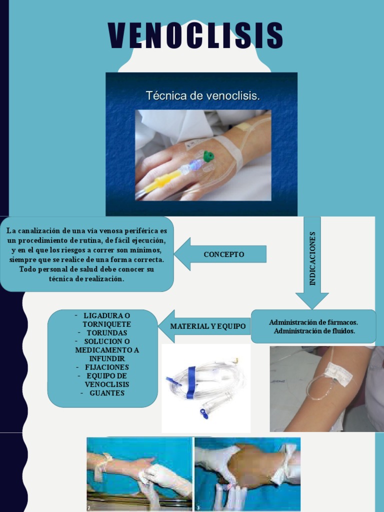 VENOCLISIS | PDF | Terapia intravenosa | Cuidado de la salud