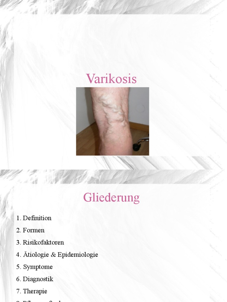 PP Varikosis - Kopie | PDF