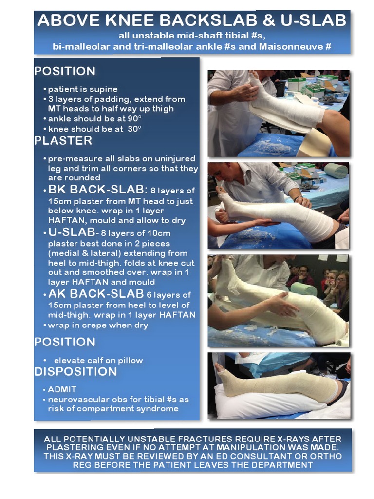 ak-back-slab-u-slab | PDF