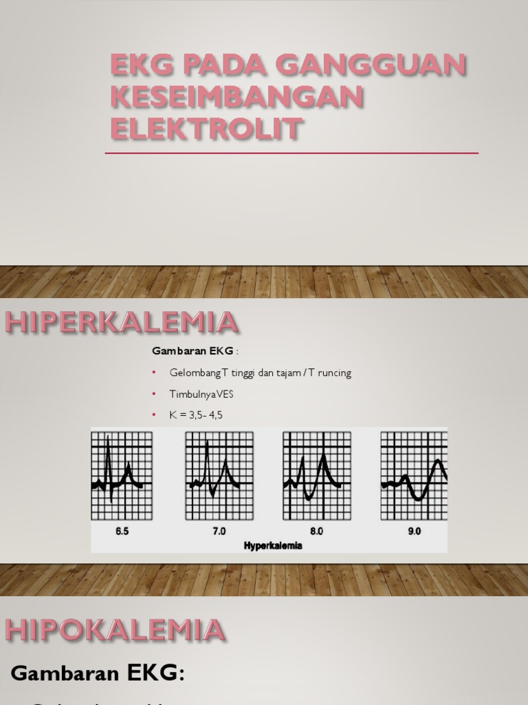 Ekg Pada Gangguan Keseimbangan Elektrolit Sugi | PDF