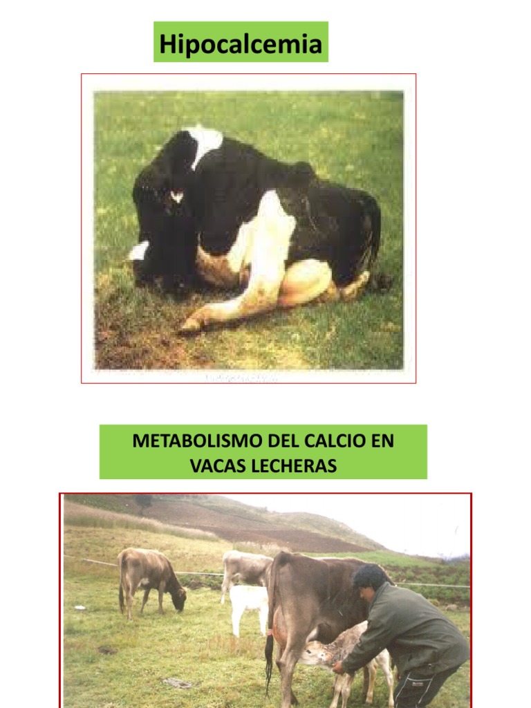 HIPOCALCEMIA | PDF