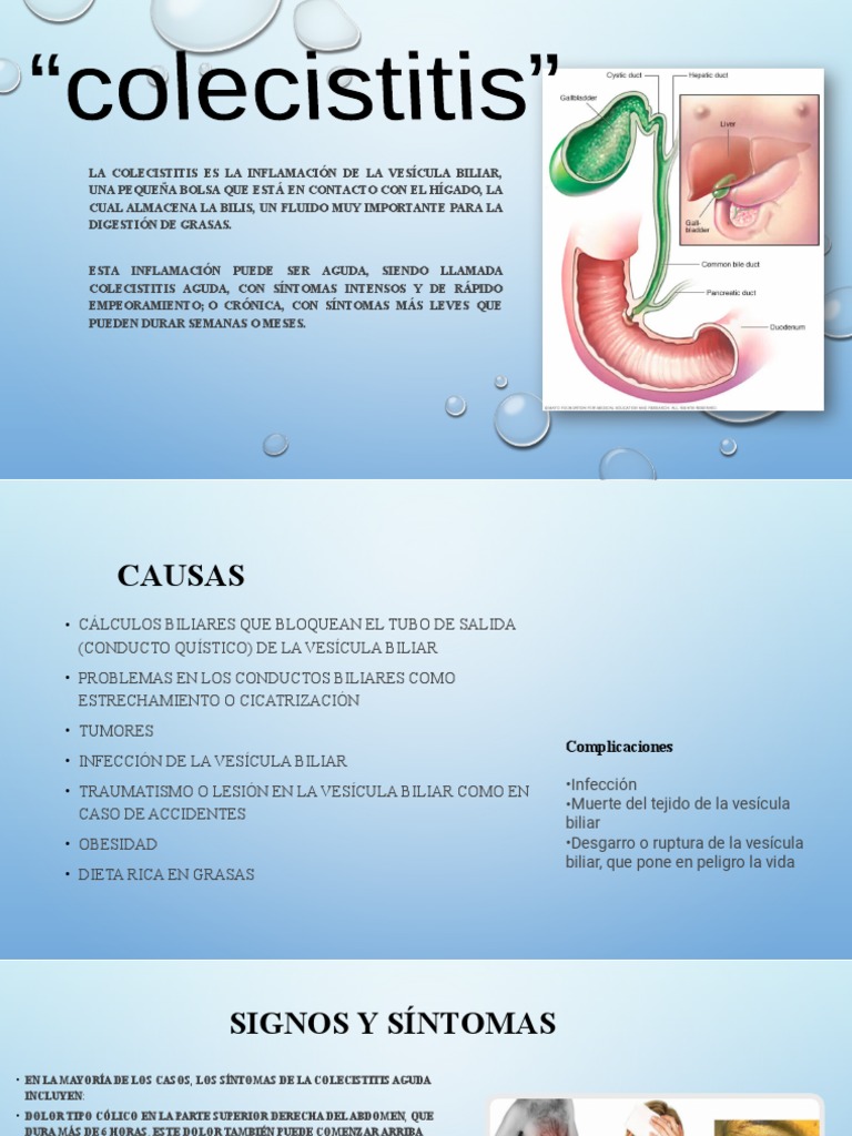 Colecistitis | PDF | Bilis | Órgano (anatomía)