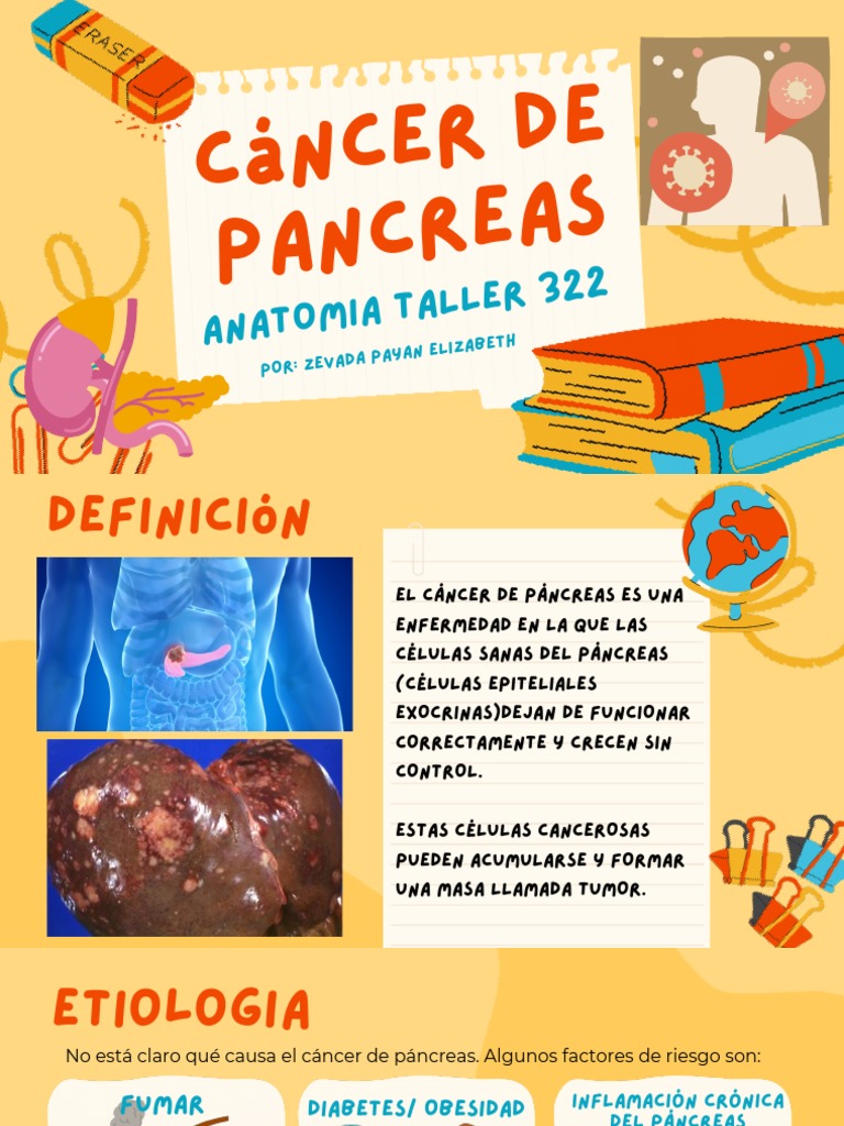 Cáncer de pancreas | PDF | Cáncer de páncreas | Cáncer