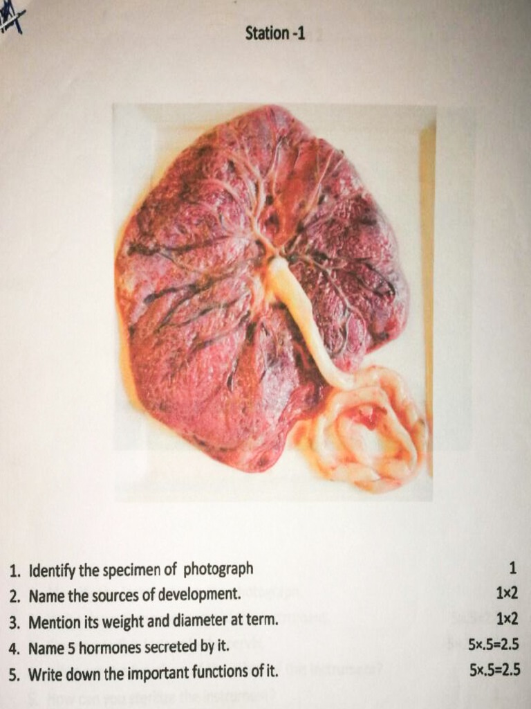Gynae Obs OSPE | PDF
