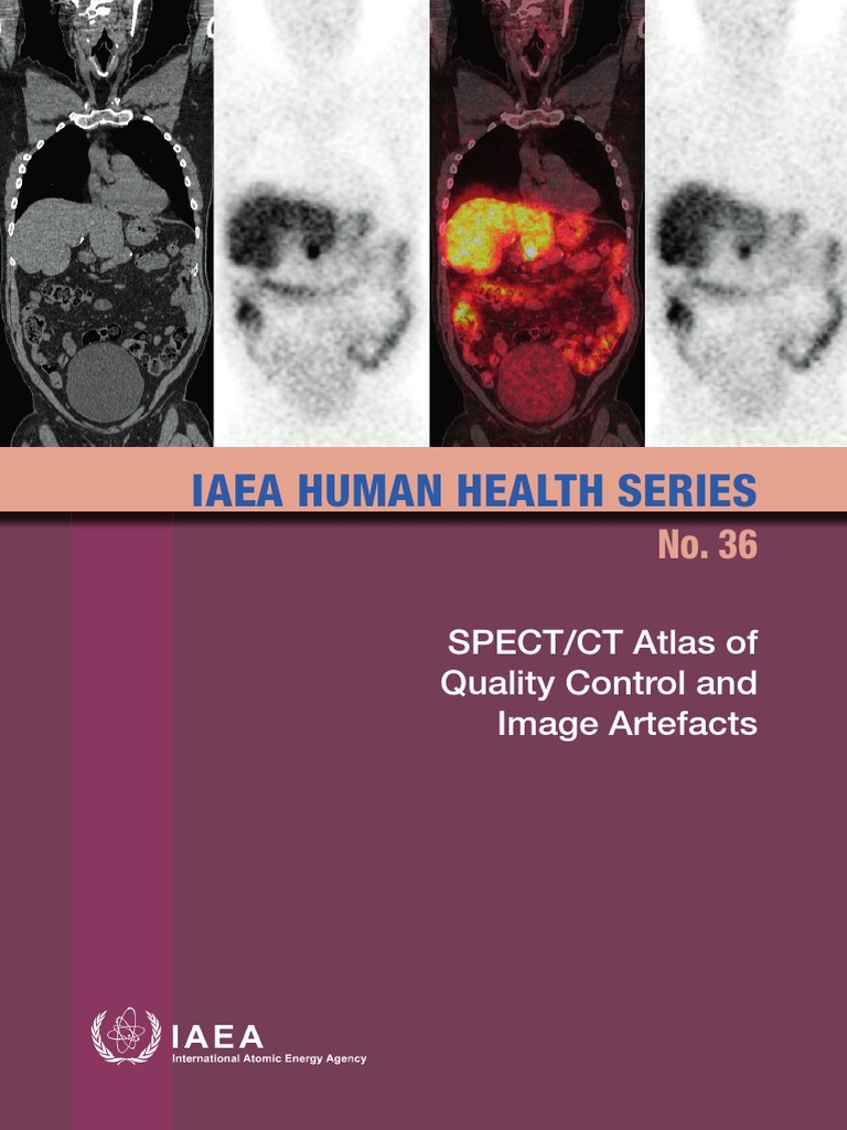 SPECT - CT Atlas of Quality Control and Image Artefacts - IAEA HHS #36 ...