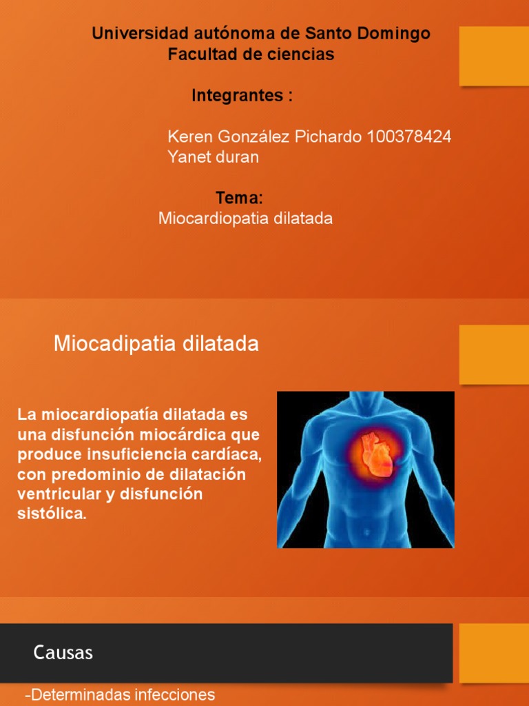 Miocardiopatia Dilatada Karen | PDF | Corazón | Insuficiencia cardíaca