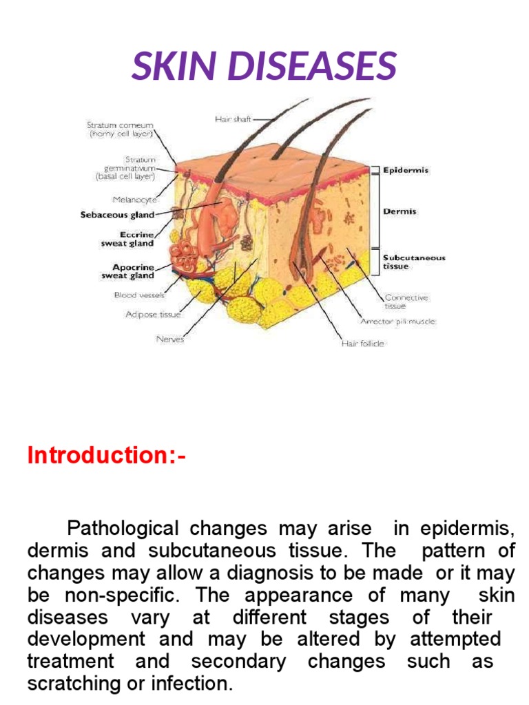 Common Skin Diseases and Infections | PDF | Psoriasis | Dermatitis