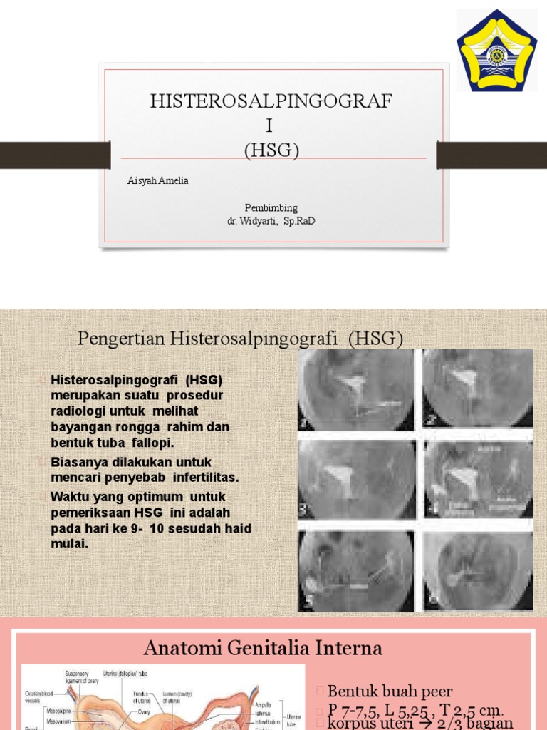 Histerosalpingograf I (HSG) : Aisyah Amelia Pembimbing Dr. Widyarti, SP - Rad | PDF