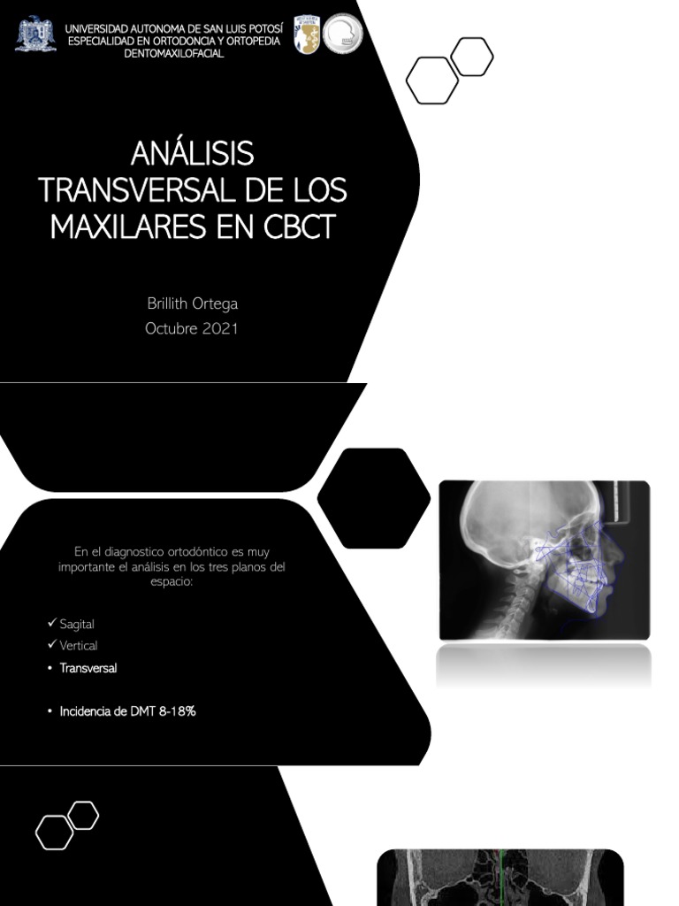 Análisis Transversal Maxilar en CBCT | PDF
