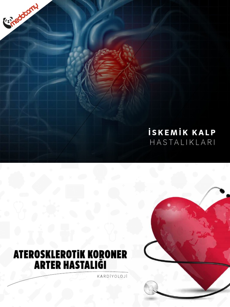 İskemik Kalp Hastalıkları Ders Notları | PDF