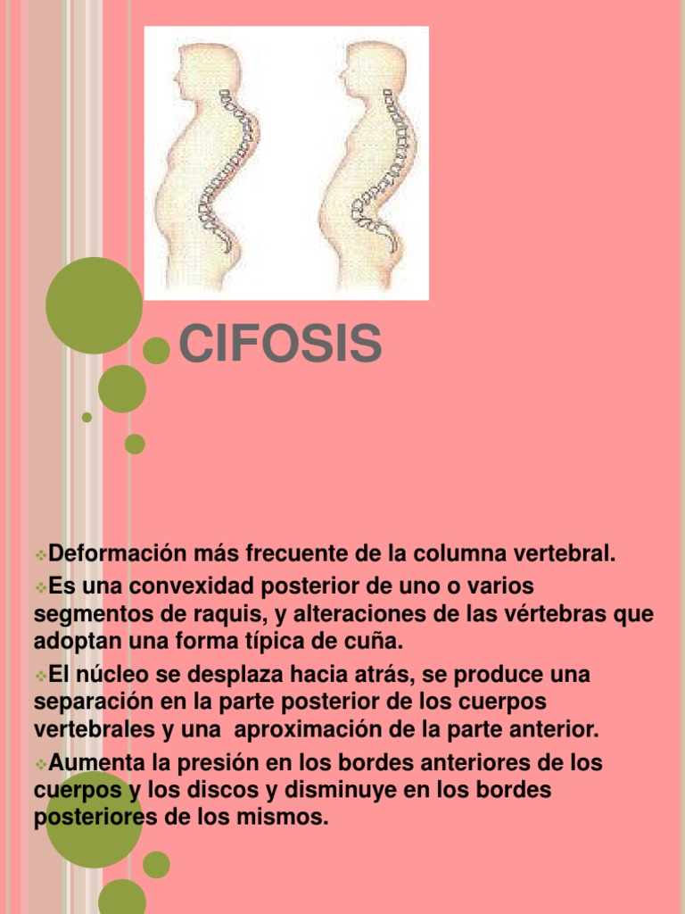 Cifosis | PDF | Vértebra | Sistema musculoesquelético