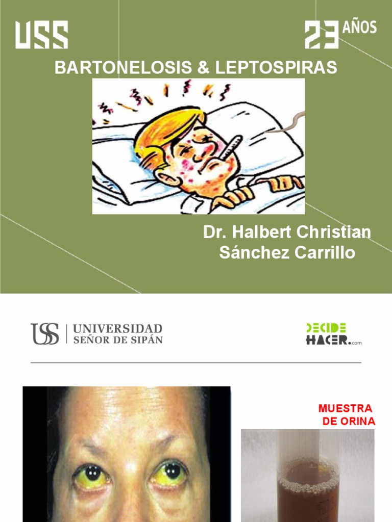 Sufusión Conjuntival en Leptospirosis | PDF | Enfermedades y trastornos ...