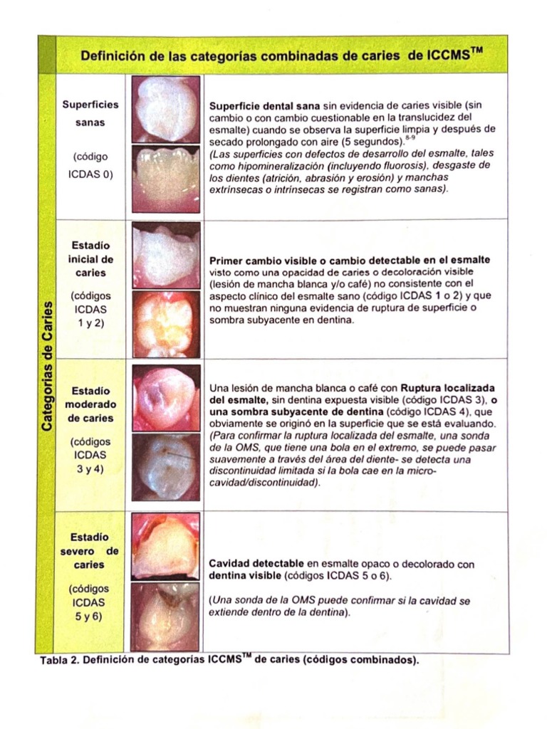 Tabla ICDAS | PDF