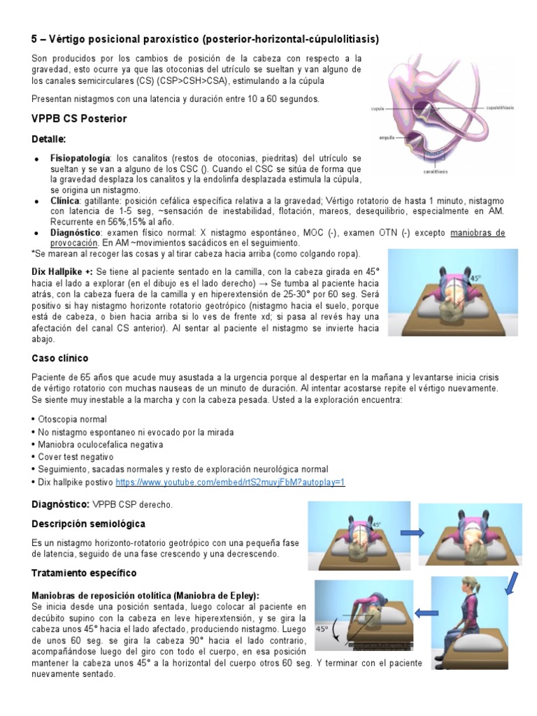 Vértigo Posicional: Diagnóstico y Tratamiento | PDF | Sistema nervioso ...