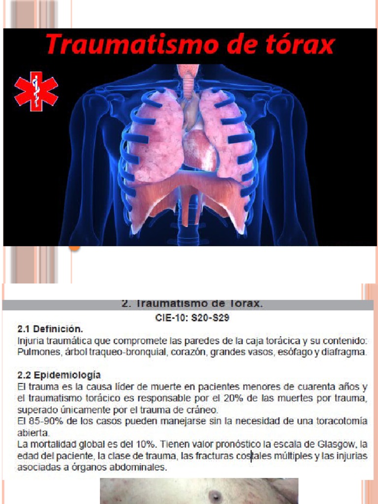 TRAUMA DE TORAX | PDF
