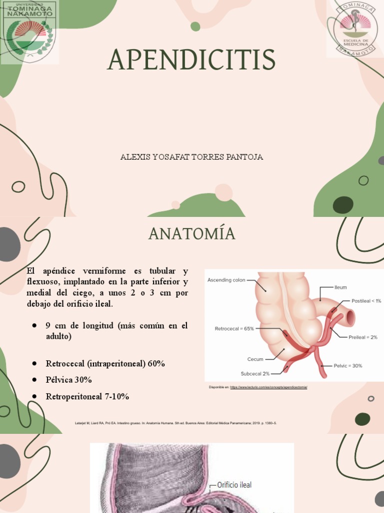 Apendicitis | PDF