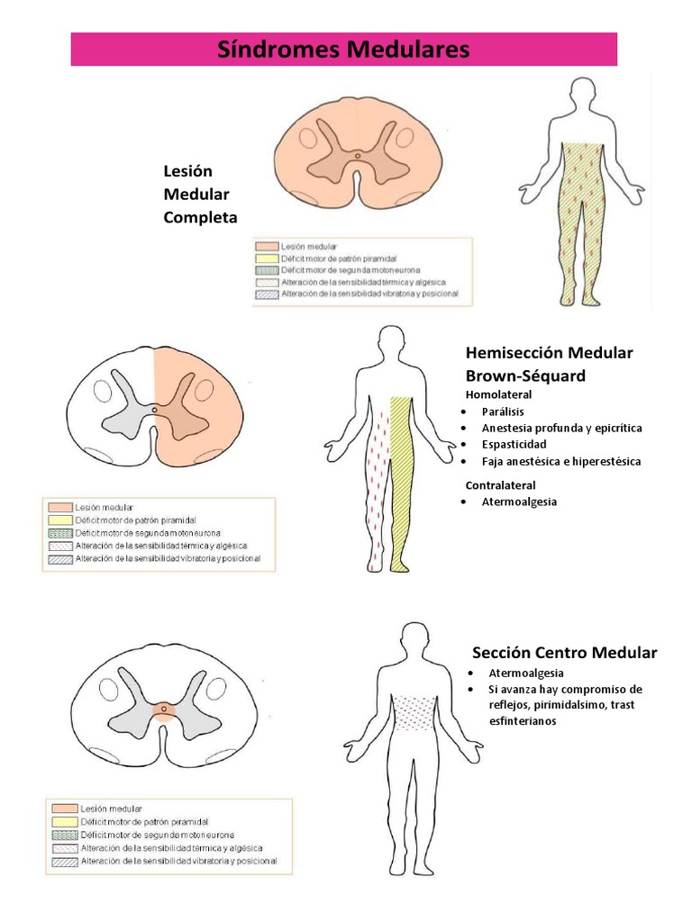 Sindromes Medulares | PDF