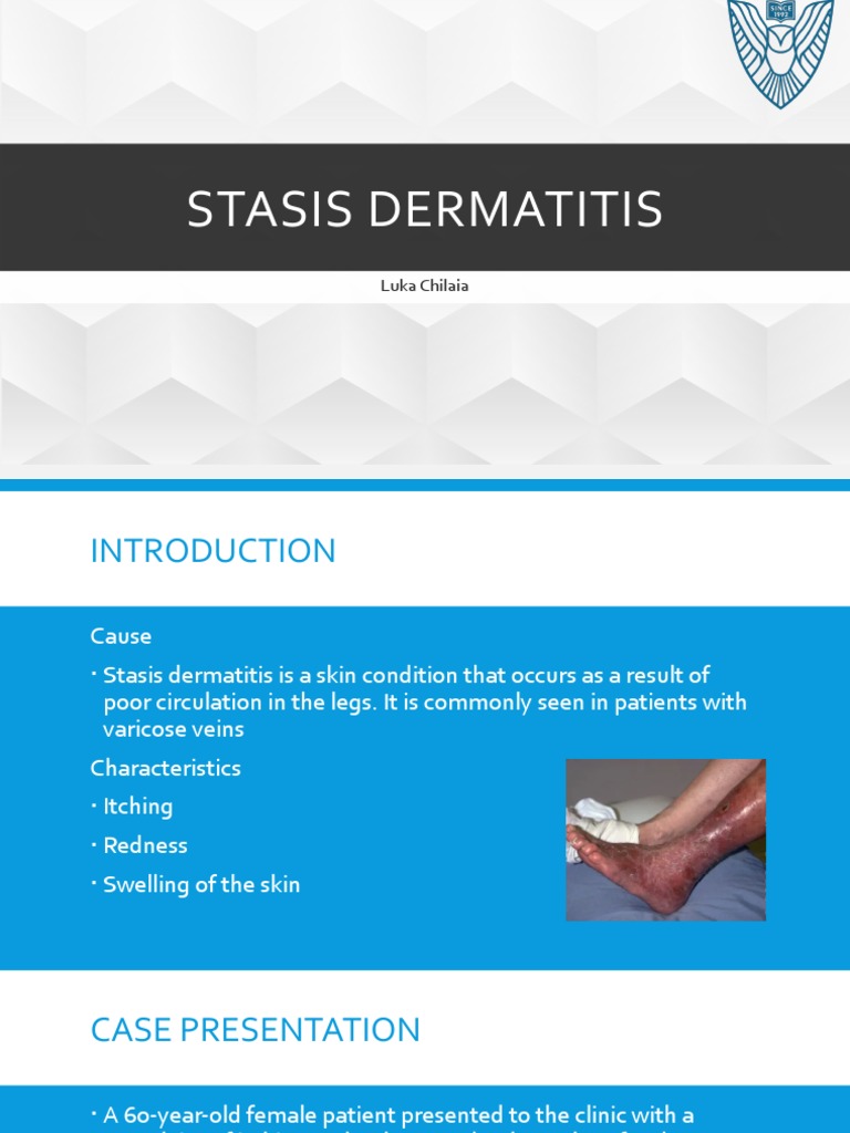 Stasis Dermatitis | PDF