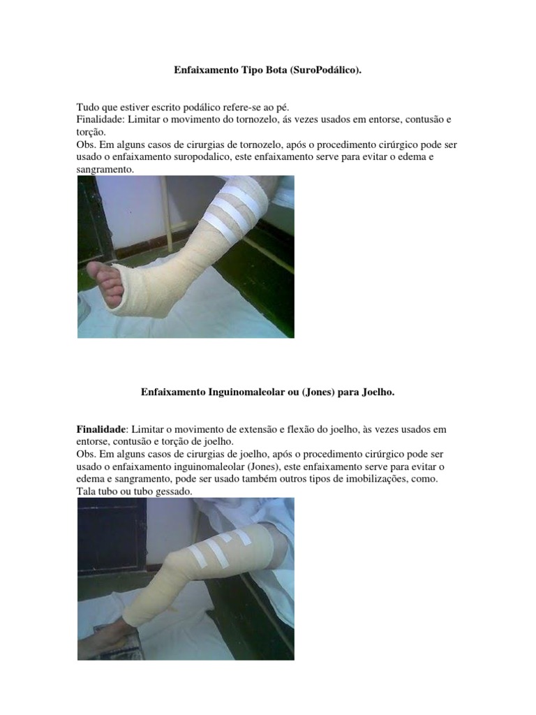 PROCEDIMENTO DE GESSO | Joelho | Cirurgia Ortopédica