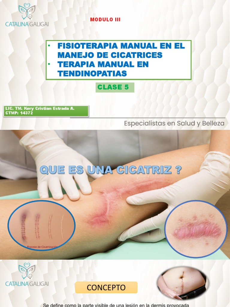 Terapia Manual en Cicatrices y Tendinopatias | PDF | Cicatriz | Herida