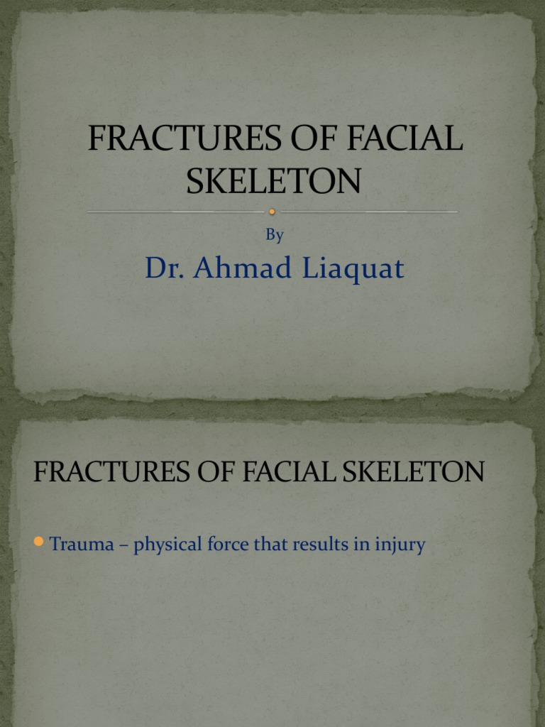 Fractures of Facial Skeleton | PDF