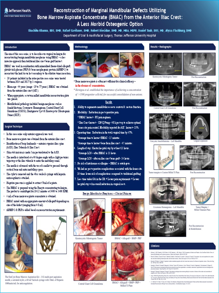Taub - Reconstruction of Marginal Mandibular Defects Utilizing Bone ...