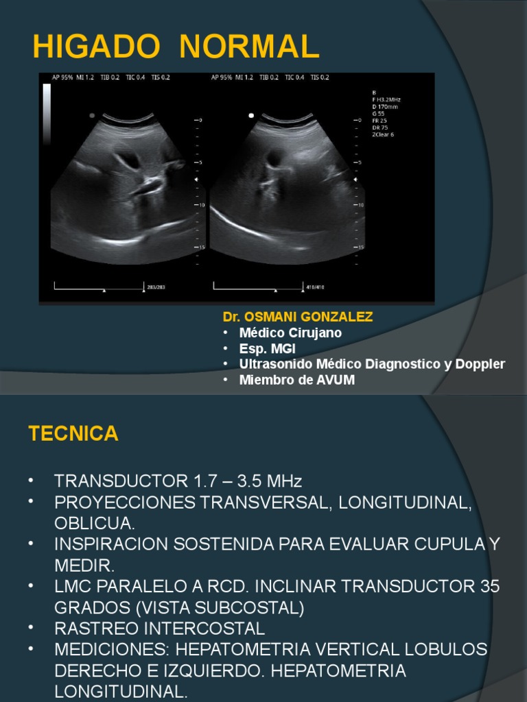 Higado Normal y Patologico - 044643 | PDF