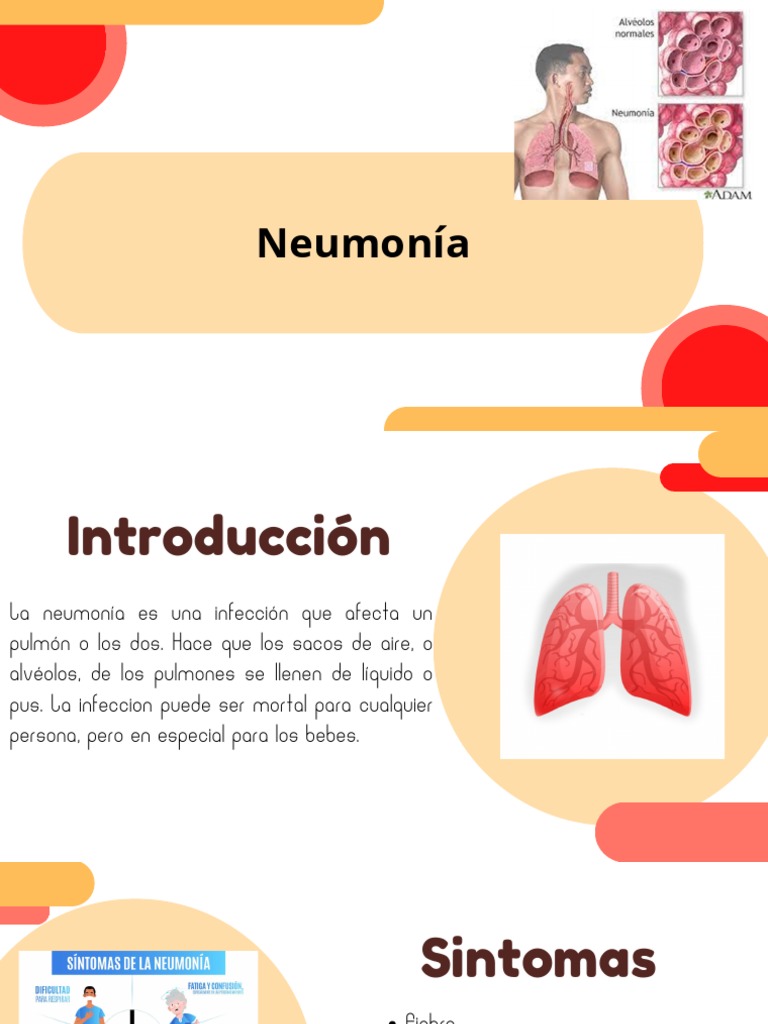 Neumonía | PDF | Neumonía | Causas de la muerte