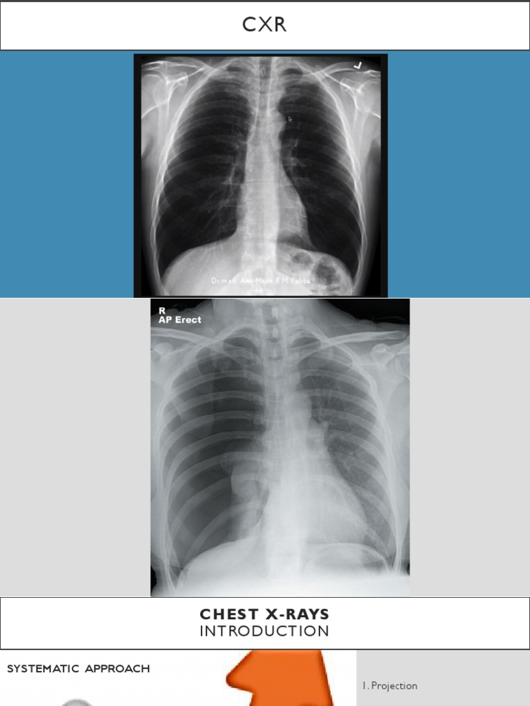 Radiology Lecture 4th Year 2022 Part 2 | PDF | Thorax | Lung