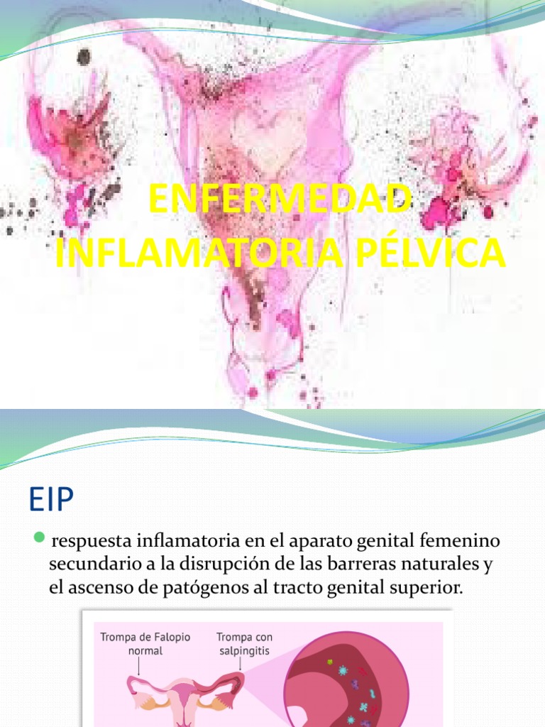 Enfermedad Inflamatoria Pélvica | PDF | Especialidades Medicas | Epidemiología