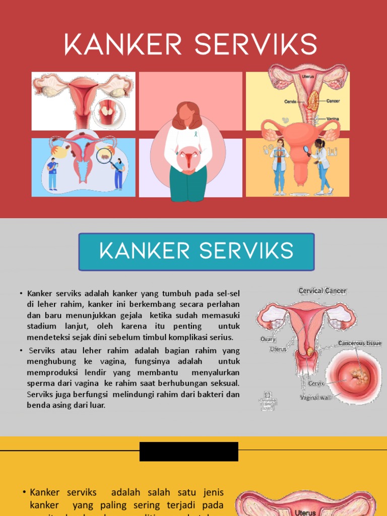 Kanker Serviks | PDF