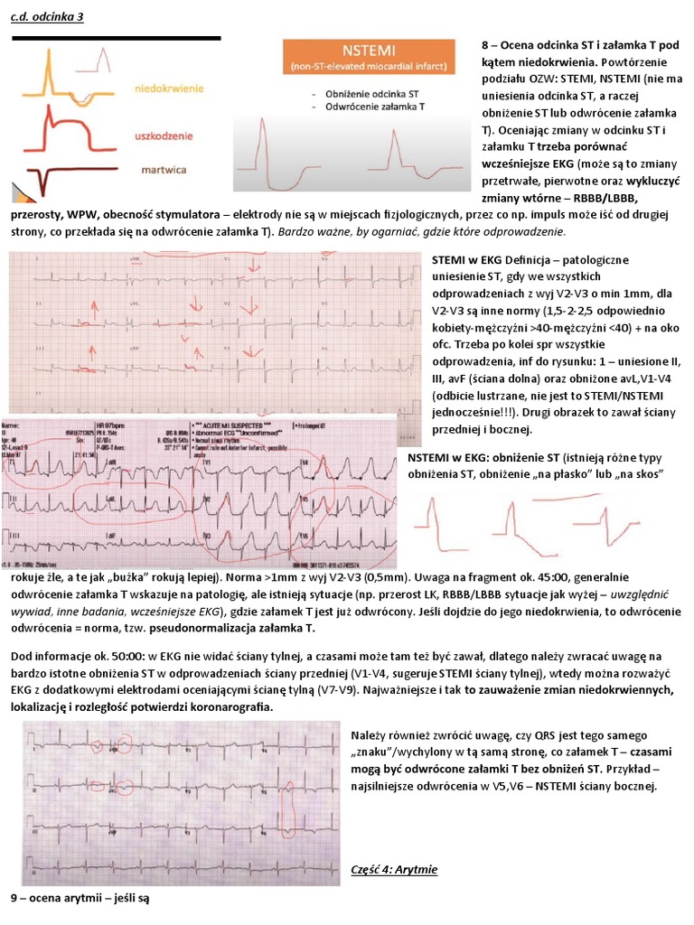 Kurs Ekg (2.5-5) | PDF