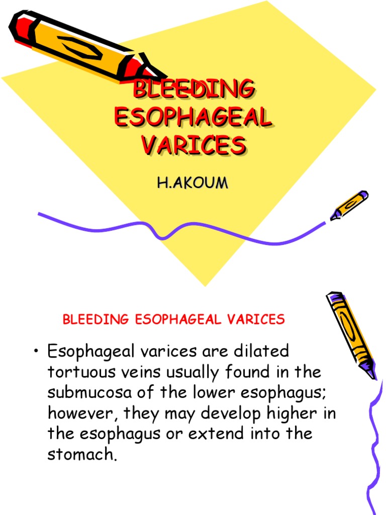 5c.BLEEDING ESOPHAGEAL VARICES | PDF | Esophagus | Medicine