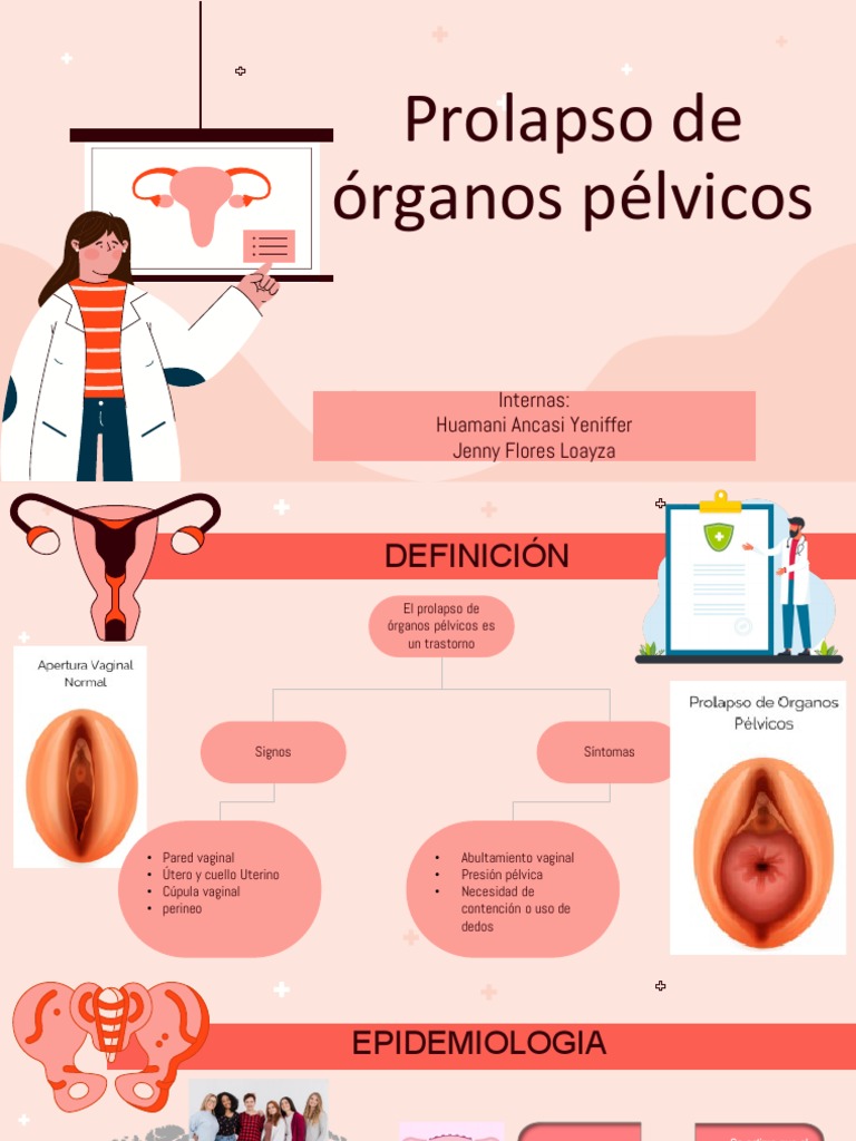 Prolapso de Organos Pelvicos | PDF | Parto | Pelvis