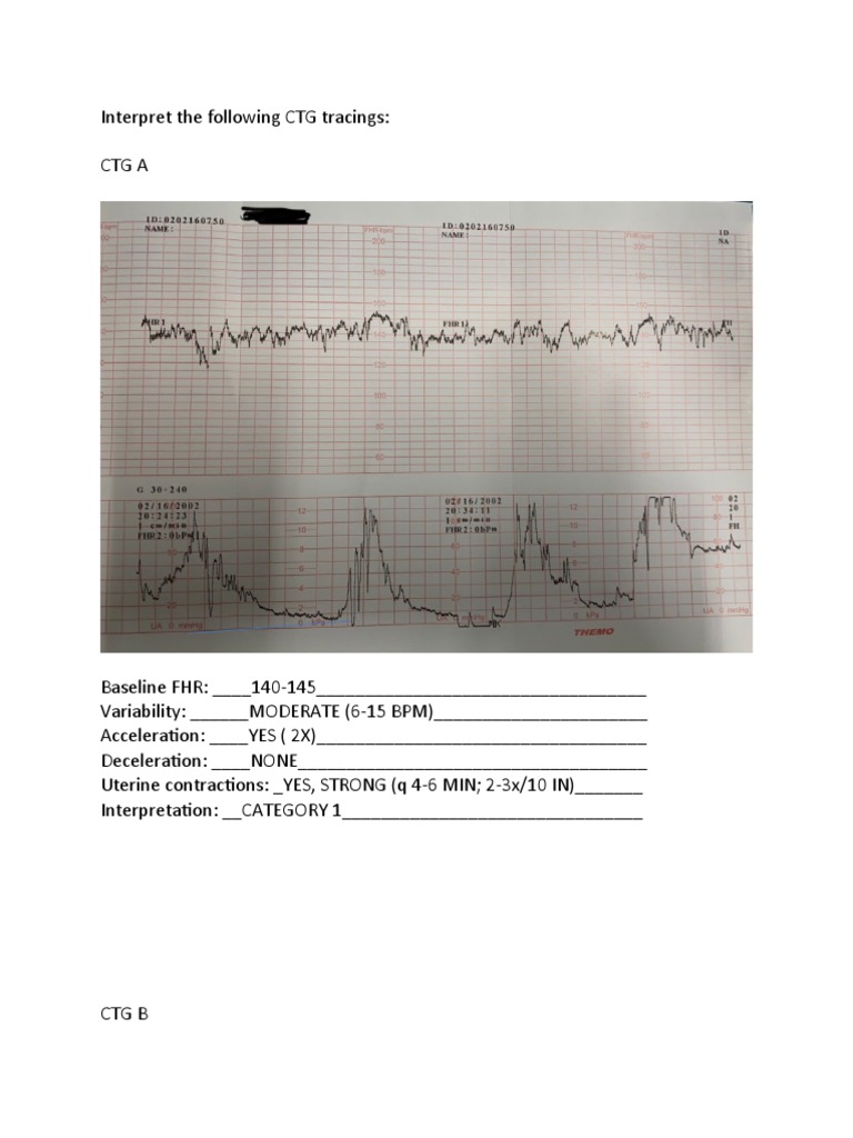 CTG Tracings WITH ANSWER | PDF | Technology & Engineering