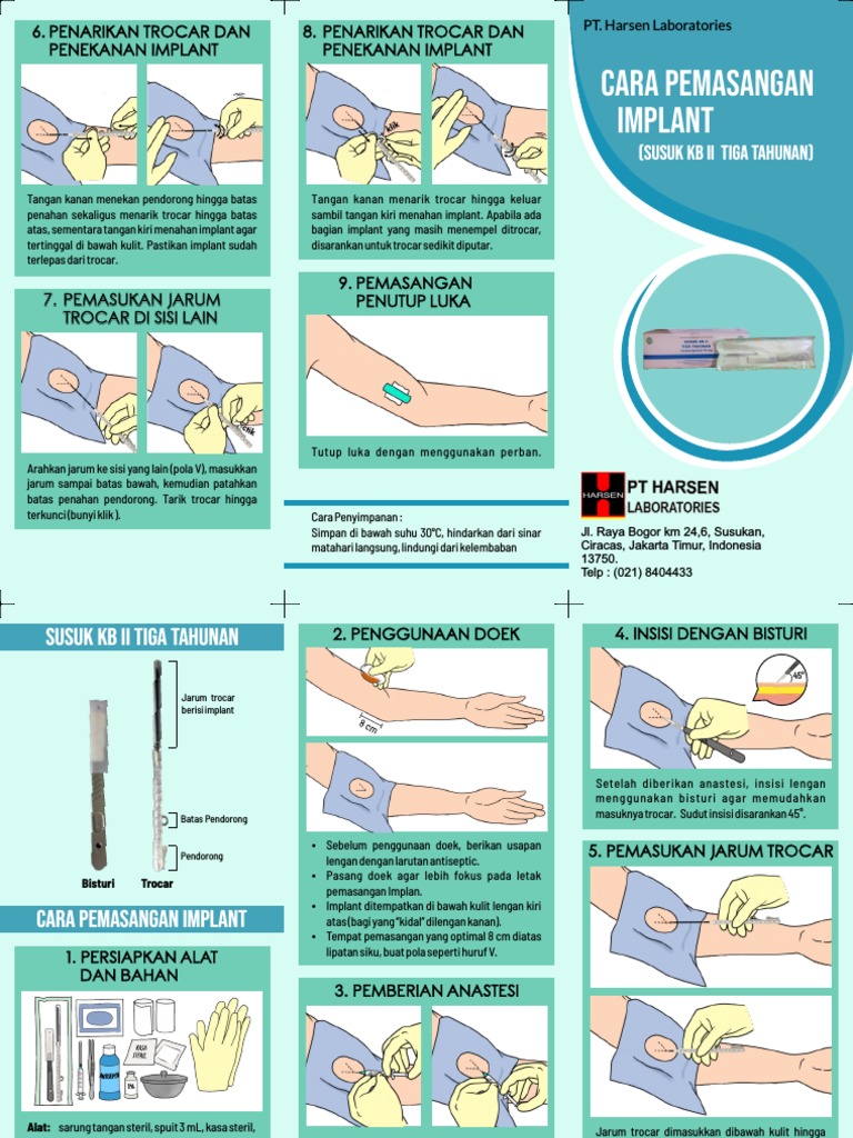 leaflet Pemasangan Implant | PDF