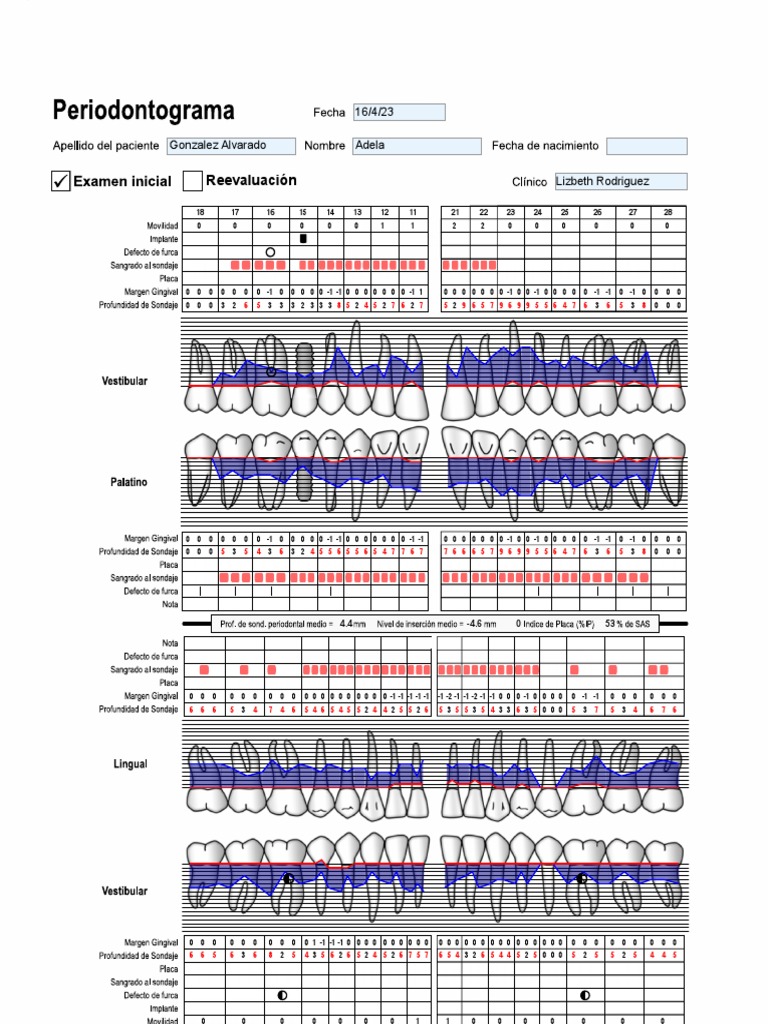 Periodontal Chart Online | PDF