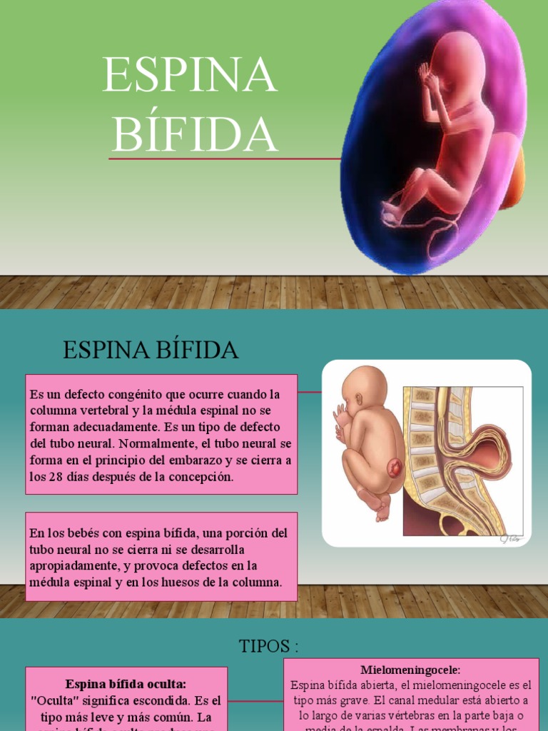 Espina Bífida: Tipos, Riesgos y Prevención | PDF | Medicina CLINICA ...