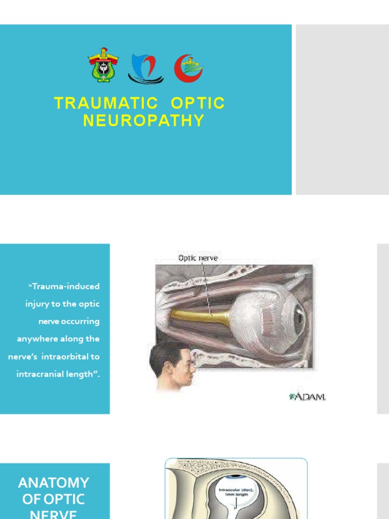 Traumatic Optic Neuropathy | PDF | Injury | Vision