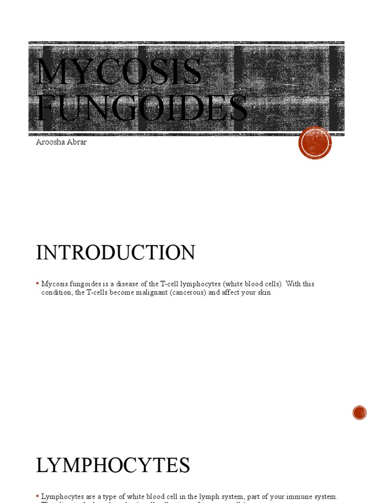 Lecture 5 Mycosis Fungoides | PDF | Medicine | Epidemiology