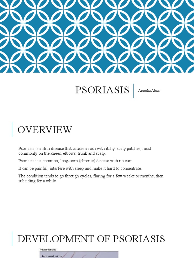 Lecture 2 Psoriasis | PDF | Psoriasis | Epidemiology