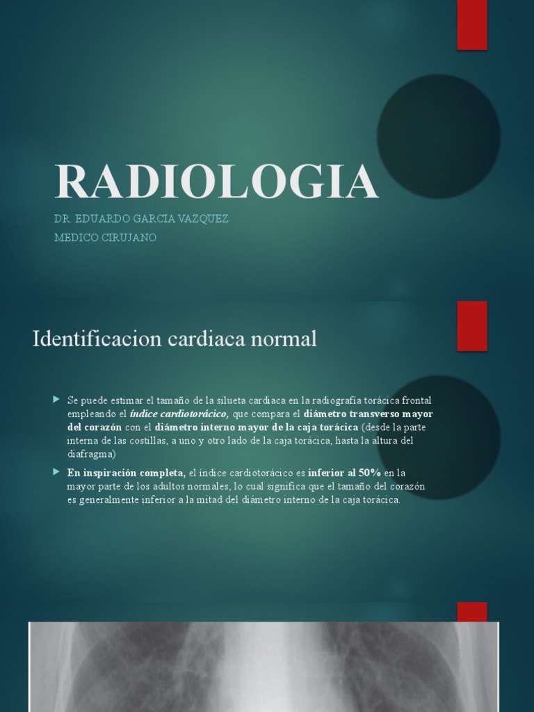 Radiologia Corazon | PDF | Corazón | Aorta