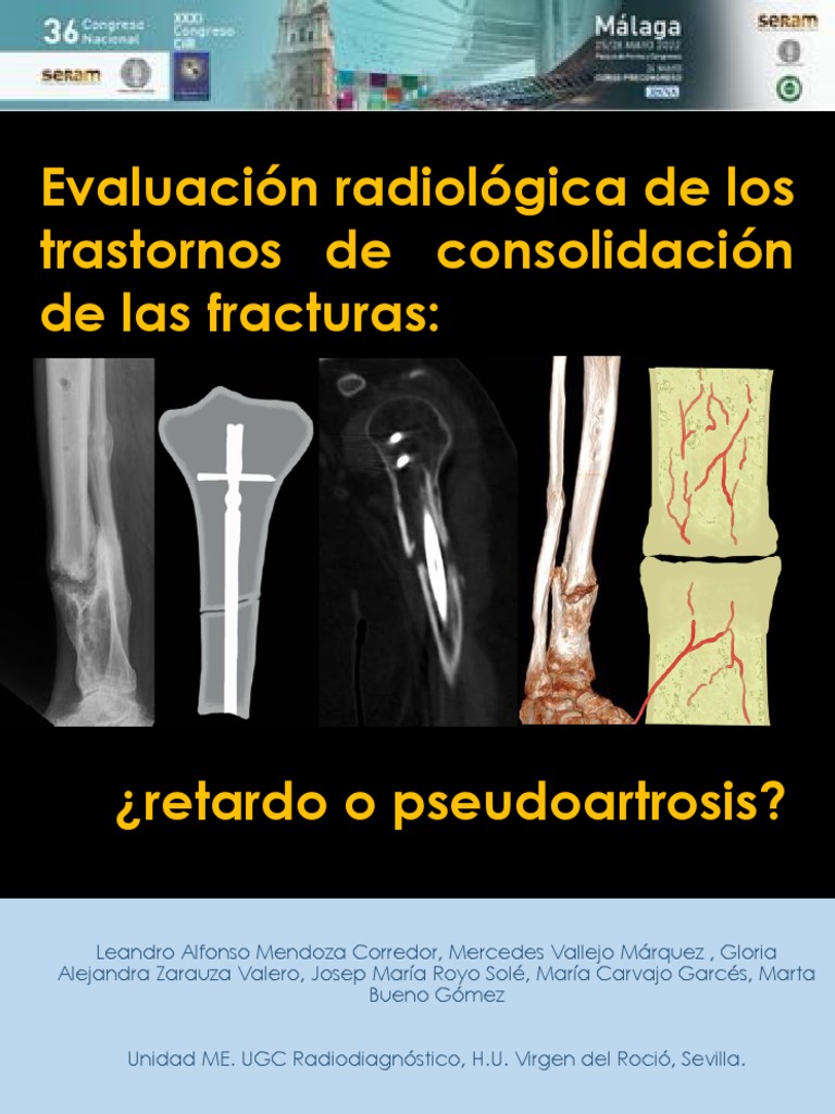 Score Rust-Rush-Rass | Descargar gratis PDF | Hueso | Medicina CLINICA