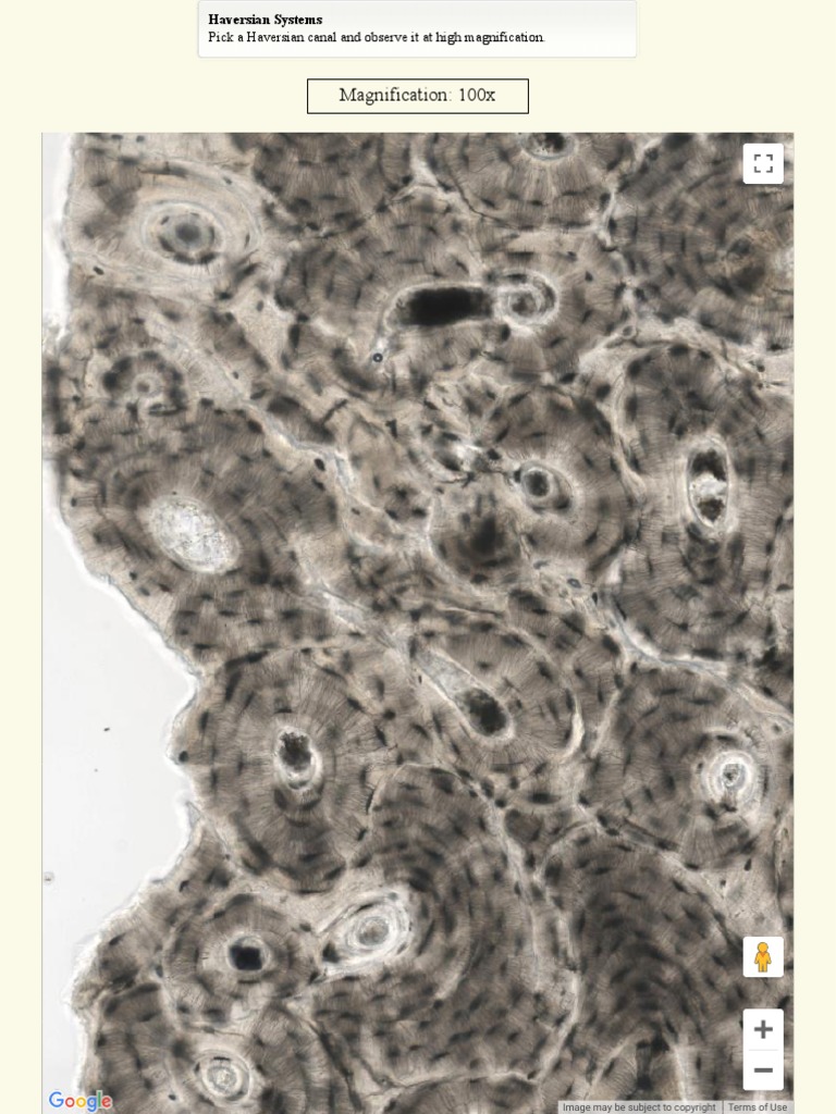 Microscopic View of Haversian Canals | PDF